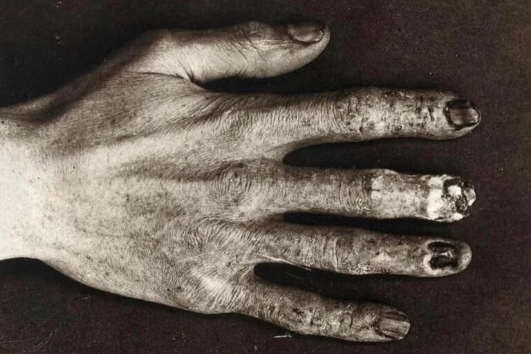 The Story Of The Radium Girls Will Shock You To Your Core