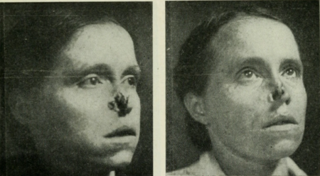 The Story Of The Radium Girls Will Shock You To Your Core